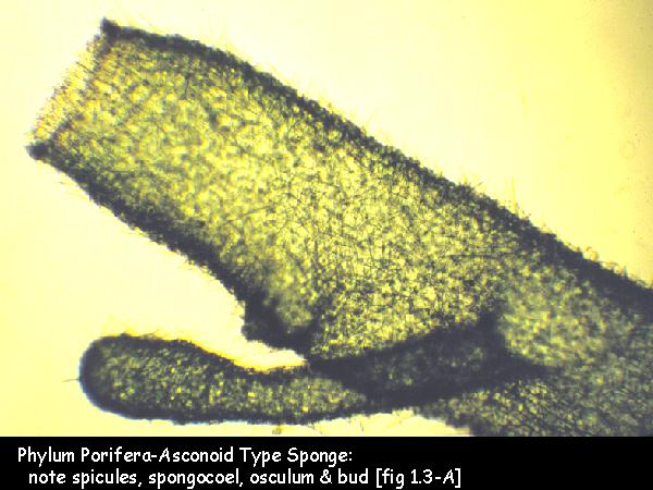 Phylum Porifera-Asconoid Type Sponge: