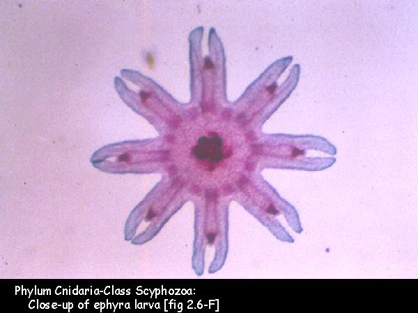 Phylum Cnidaria-Class Scyphozoa: